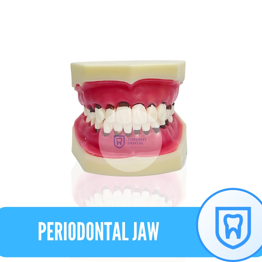 Periodontal Model 1 Model Perio Typo Jaw | Shopee Philippines