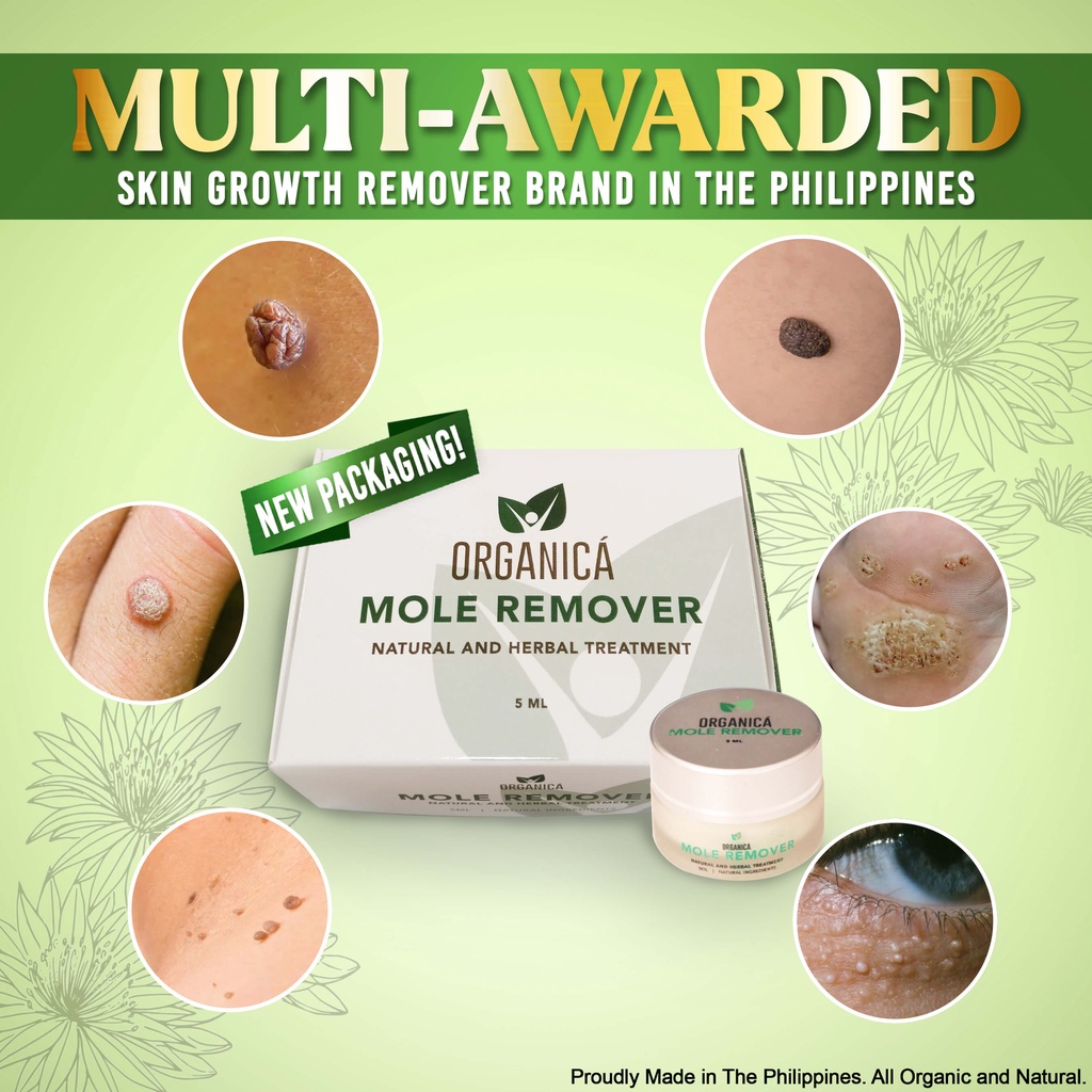 Organica Mole and Warts Remover | Shopee Philippines