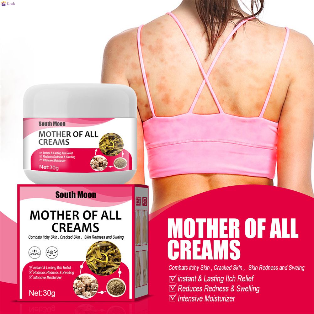 South Moon Antibacterial Cream Skin Psoriasis Cream Dermatitis