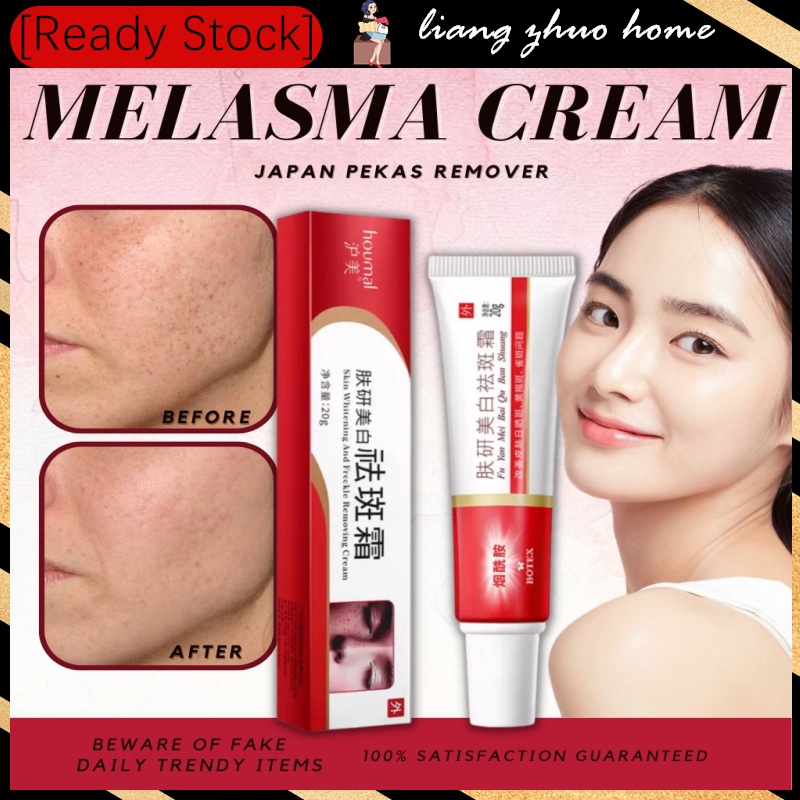 Melasma Cream Pekas Remover Collagen Japan Pekas Remover Original Pekas ...