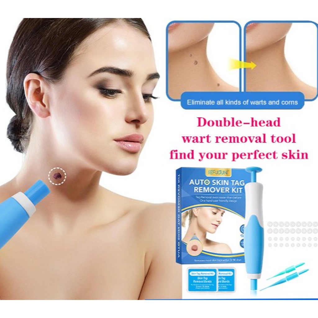 Double-ended skin tag remover tool kit for removing corns, warts, moles ...
