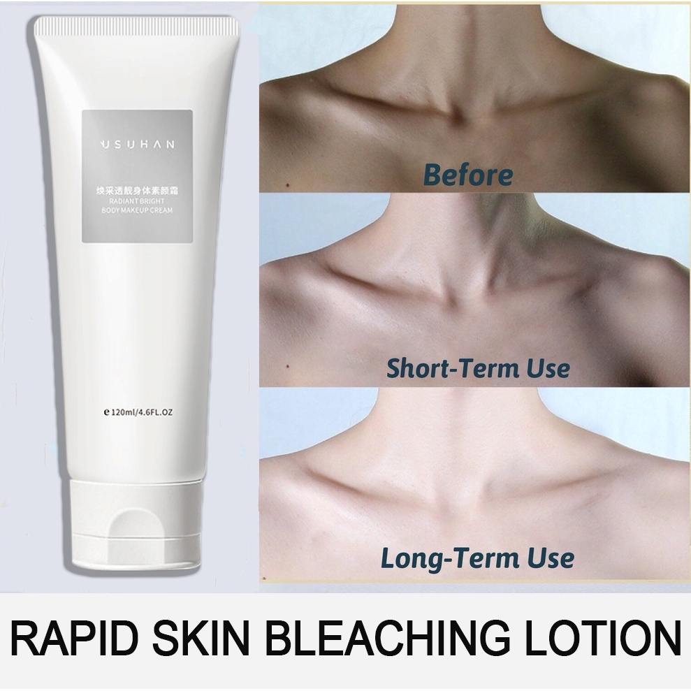 Rapid Skin Bleaching Cream Body Whitening Cream Niacinamide Brightening Face & Body Cream 120ML ...