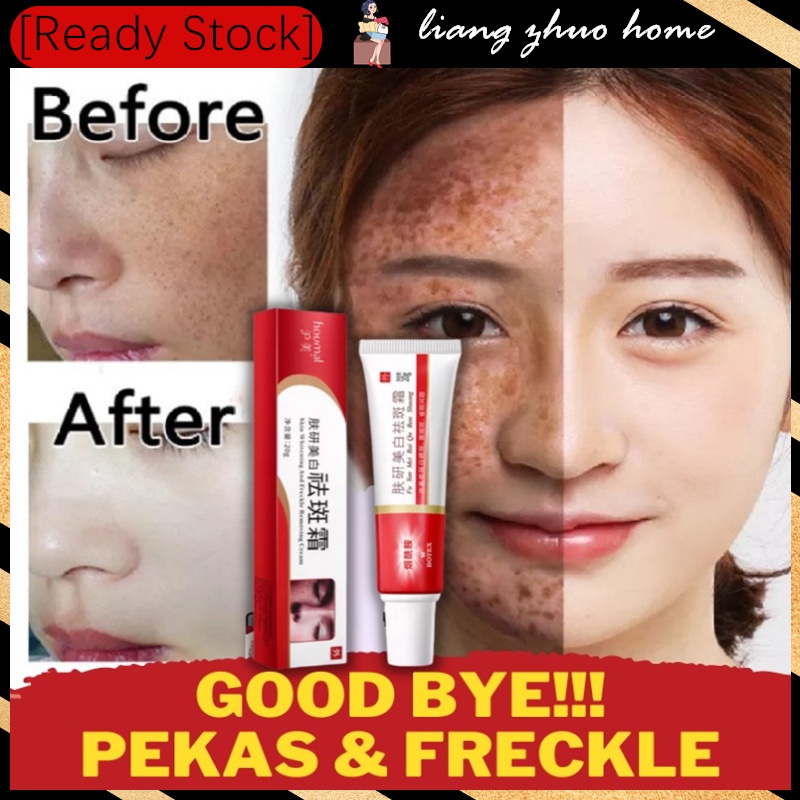 Original Pekas & Freckles Remover Cream Melasma Cream Pekas Remover ...