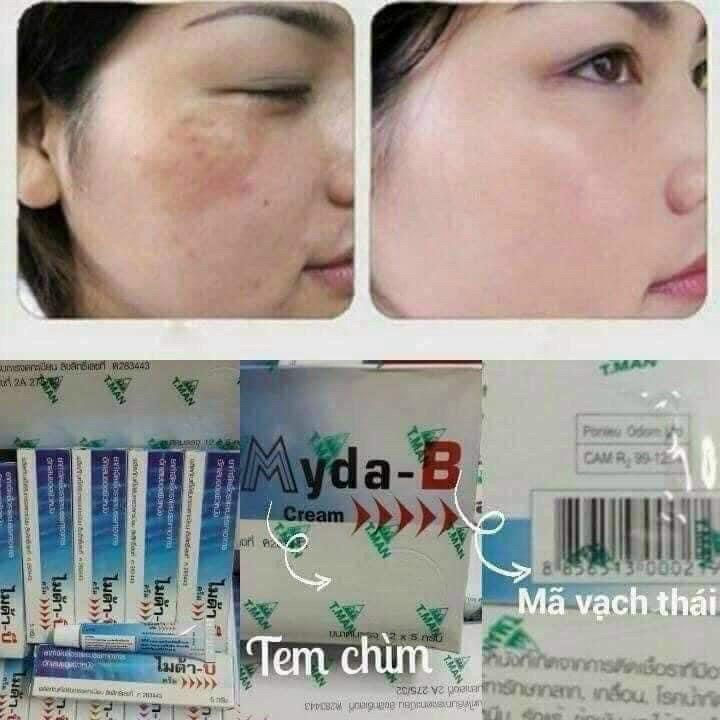 Genuine Thai Slingshotm Myda-B cream (all sizes) | Shopee Philippines
