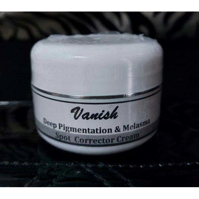 VANISH CREAM (MELASMA CREAM) | Shopee Philippines