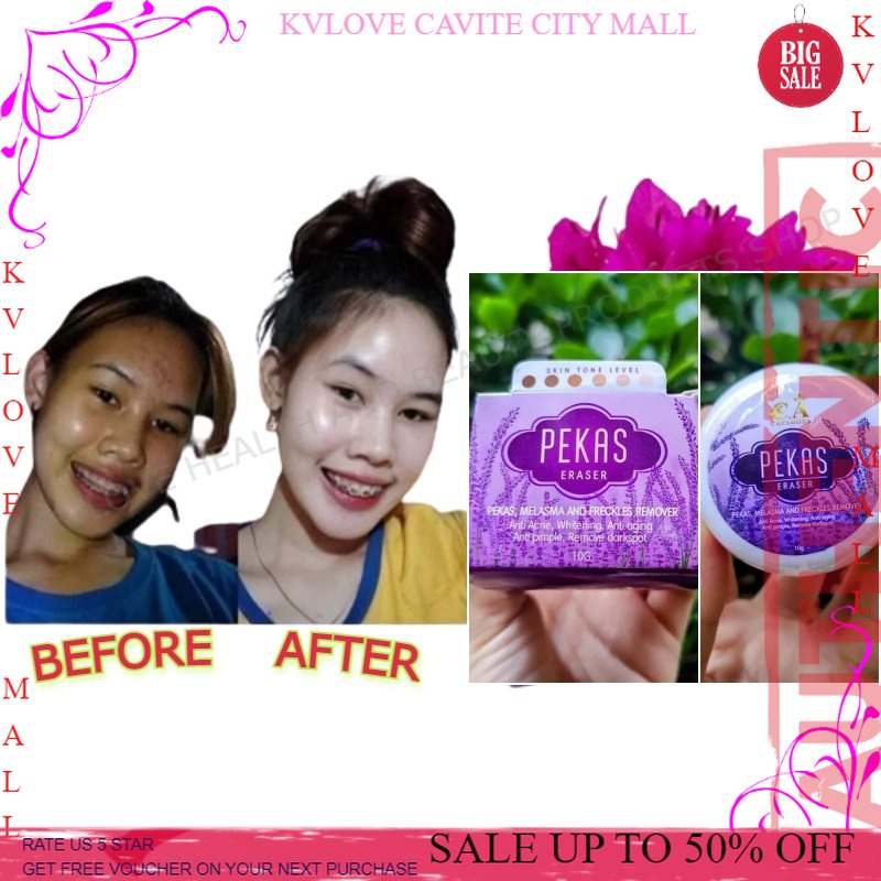 Capadosa Pekas Eraser Cream (10g) KVLOVE cavite city mall | Shopee ...
