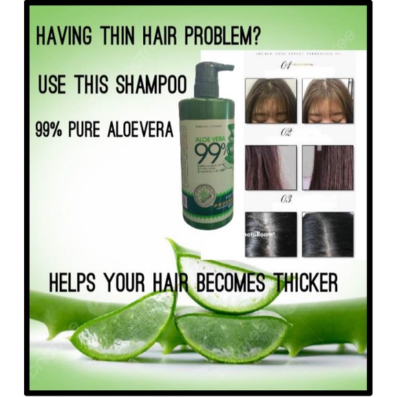 99% Aloe Vera Hair Shampoo 800ML BEST FOR HAVING THIN HAIR | Shopee ...