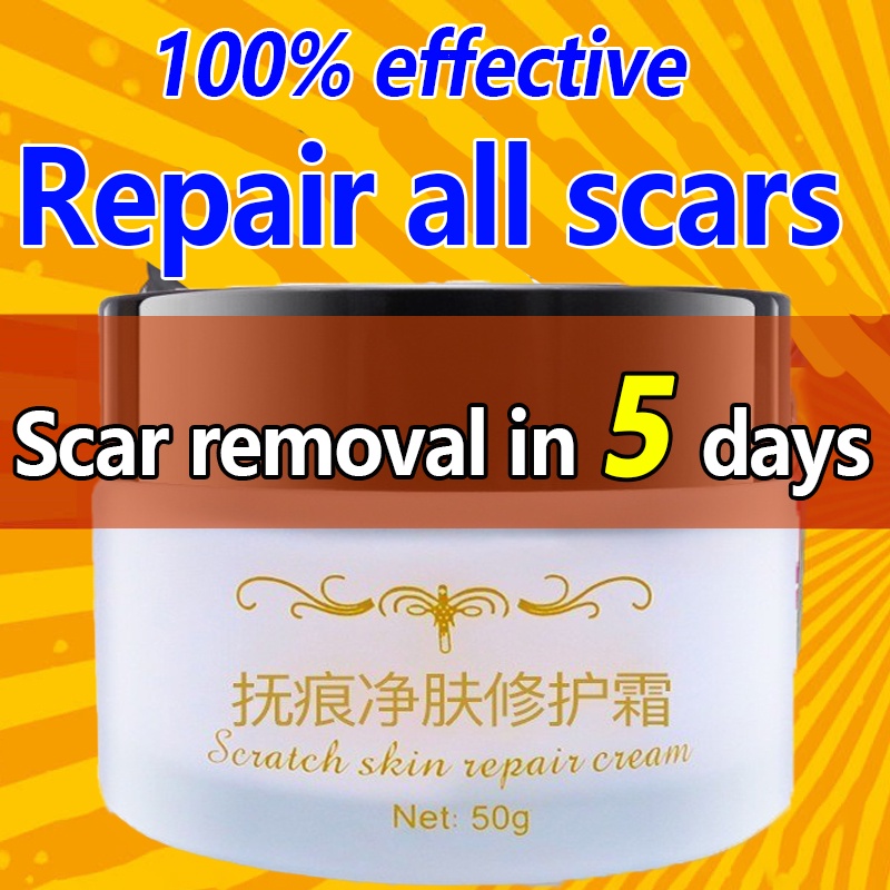 scar remover for old scar on leg 50g Old Scar Scar Remover Cream Scar ...