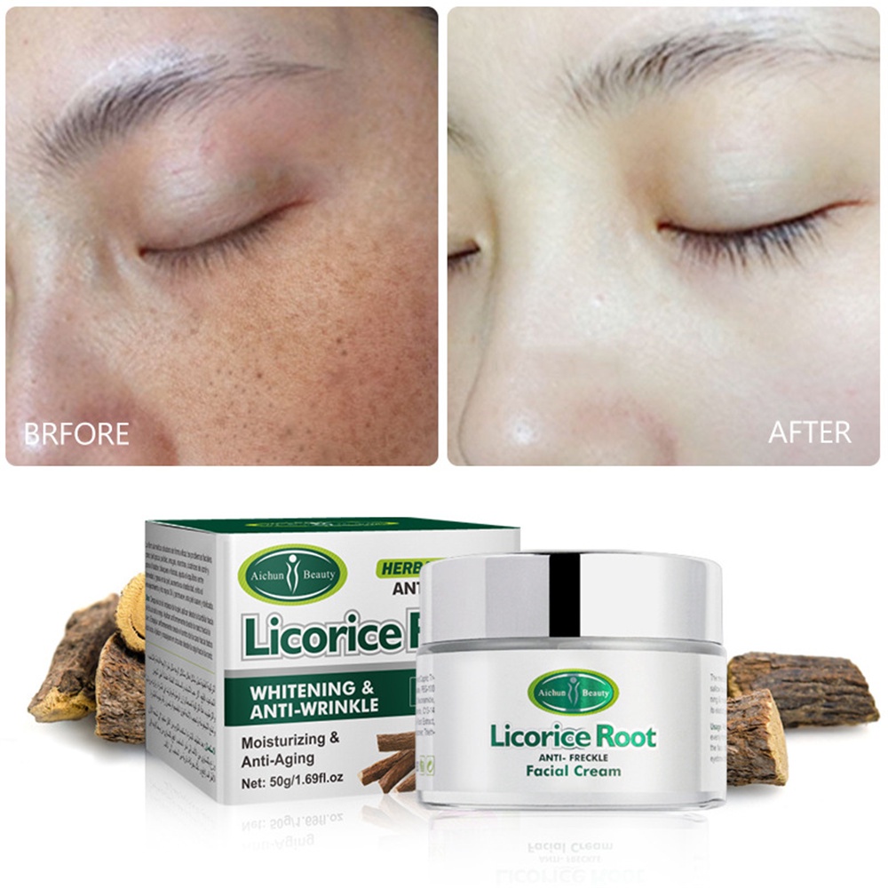 Licorice Root Face Cream Anti-freckle Whitening Serum Fade Acne Marks ...