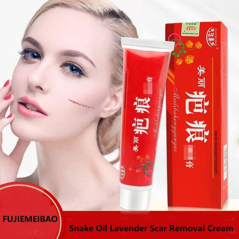 Snake Oil Lavender Scar Removal Cream Scar Repair Stretch Marks Burns ...