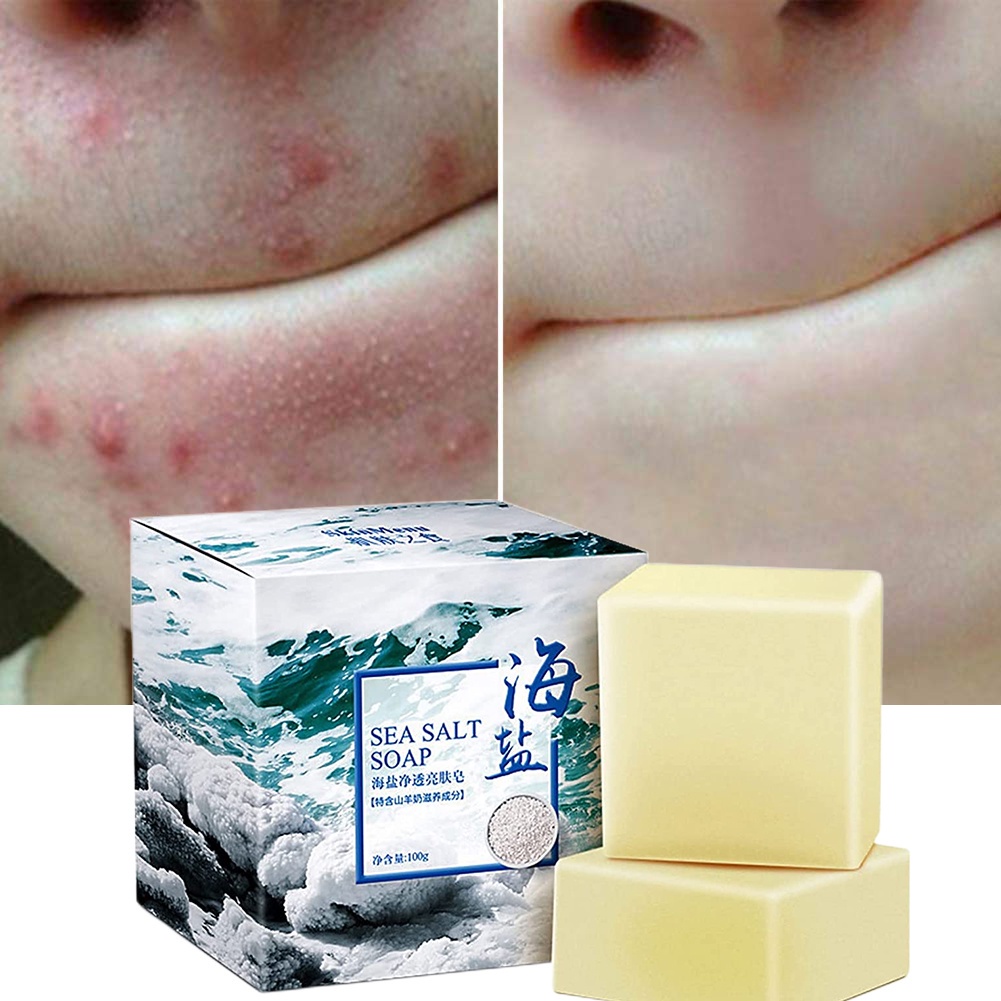 Sea Salt Soap Removal Pimple Pores Acne Treatment Cleaner Moisturizing ...
