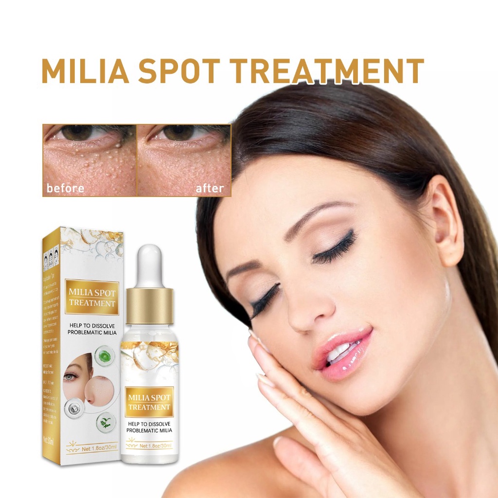 Milia Remover Essence Milia Spot Treatment Helps Dissolve and Reduce ...