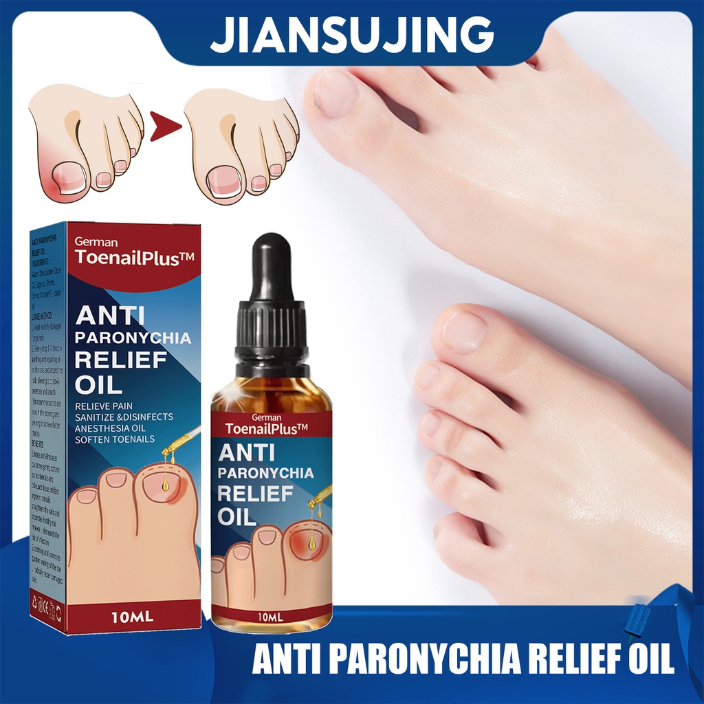 Jaysuing Anti-Nail Ditch Relief Oil Nail Groove Care Oil Onychomycosis Nail Anti Paronychia ...