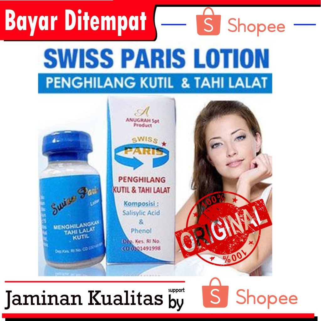 Swiss Paris Mole And Wart Removal Lotion Bpom100% Original | Shopee ...
