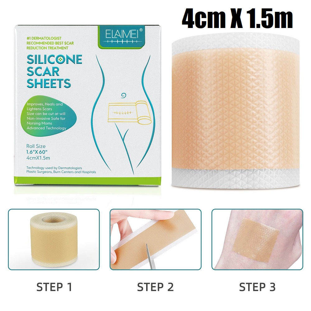 4x150cm Silicone Scar Sheets Painless Scar Repair Tape Roll Effective ...