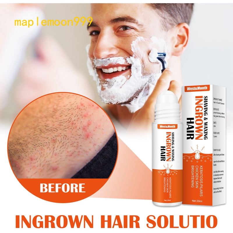 20ml Ingrown Hair Essence Bump Removal Stopper Treatment Shaving Reduce ...