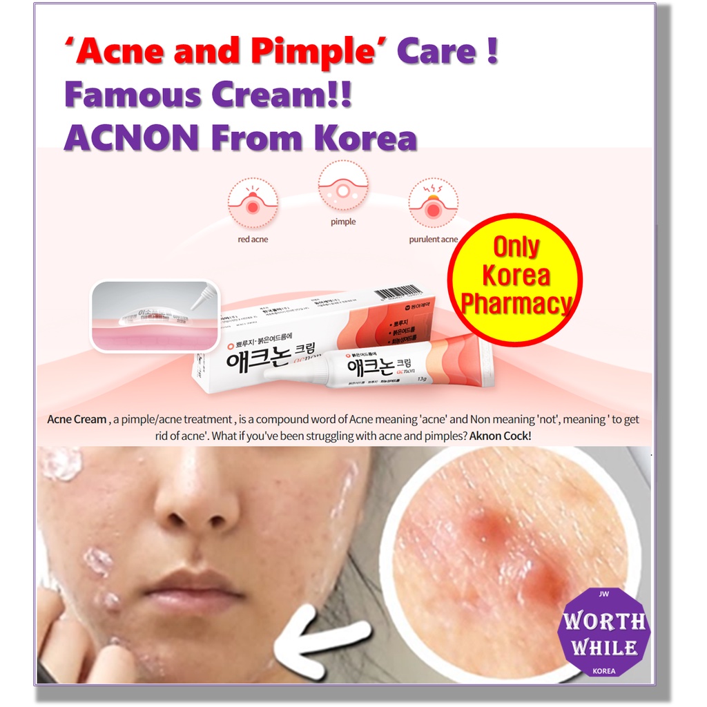 Acnon Cream 13g, Ointment From Korea /Removal of acnes and pimples ...