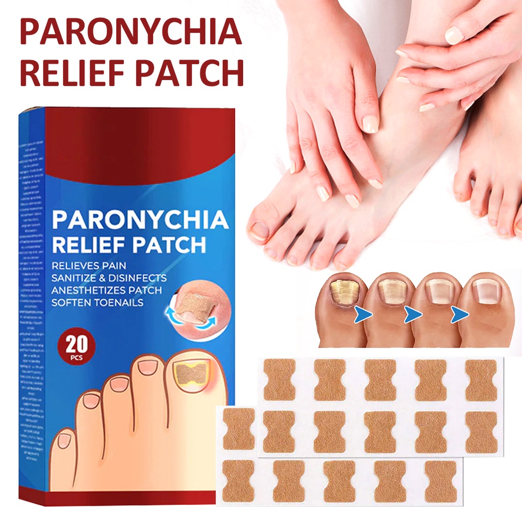 20pcs Paronychia Relief Patch Ingrown Toenails Correction Stickers ...
