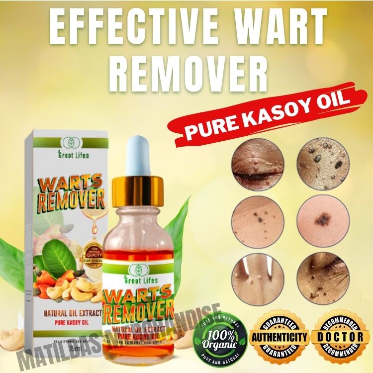 KASOY OIL REMOVAL WARTS SKIN TAGS BIG MOLE BUHAY NA NUNAL KULUGO PWEDE ...