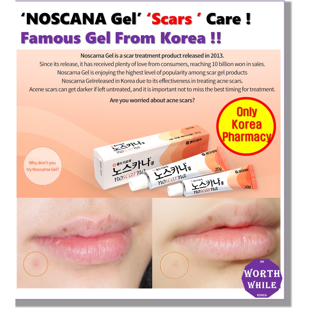 Noscarna gel 10g, Ointment From Korea /Scar Removal /Acne & Pimple ...