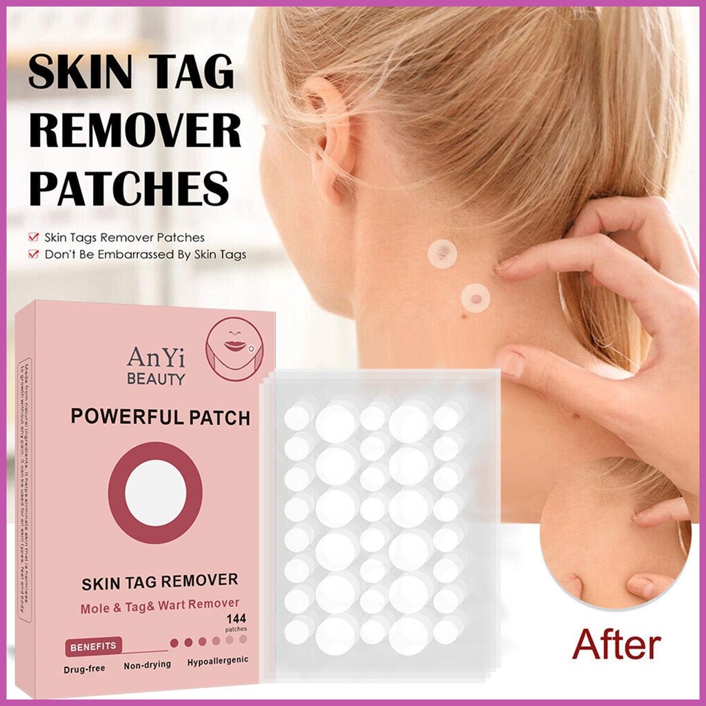 Skin Care Patches Beauty Tool Wart Removal Patch Skin Tags Remover ...