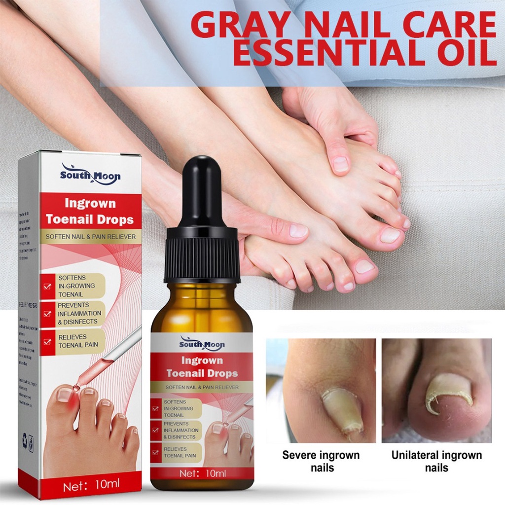 10ml Treatment Softener Essential Oil Ingrown Toenail Drops Pain ...