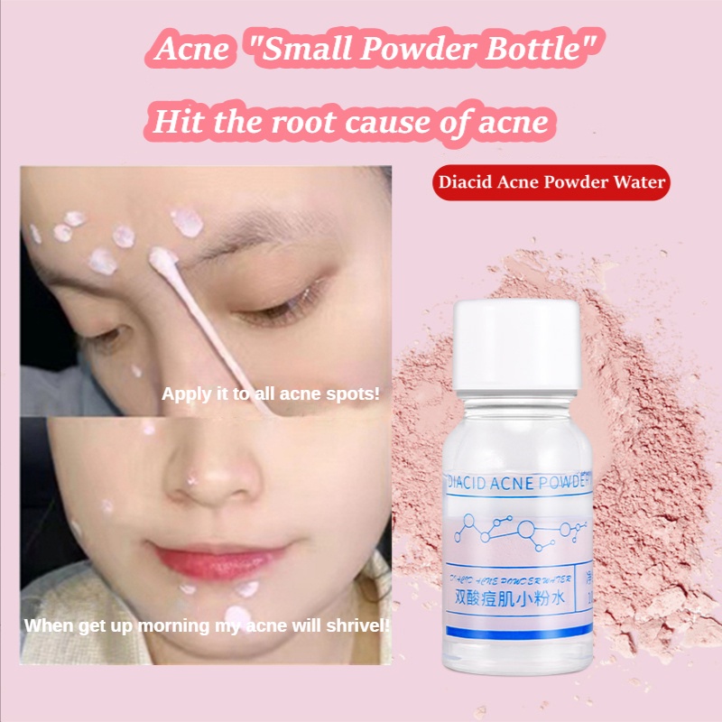 YANLI Dr. Pimple (Acne Spot Treatment) Salicylic Acid Acne Drying ...