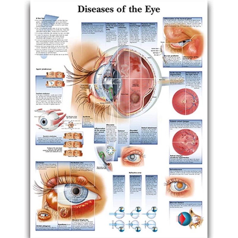 Diseases of the Eye Anatomy Posters for Walls Nursing Students ...