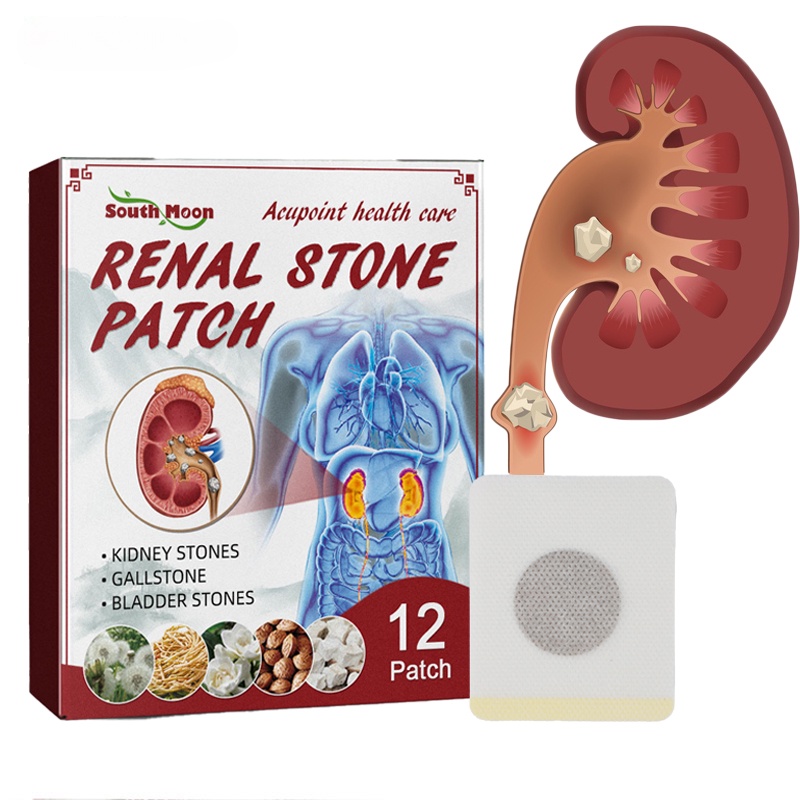12Pcs/Box Kidney Stones Removal Patch Treat Gallstones Body Detox ...