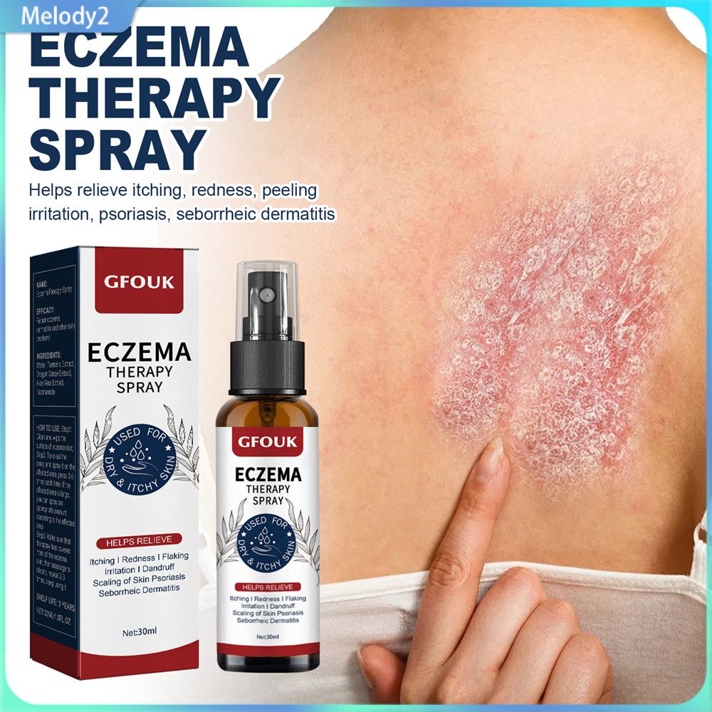 GFOUK 30ML Relieve Itchy Skin Lichen spray Net Cleaning Bacterial ...