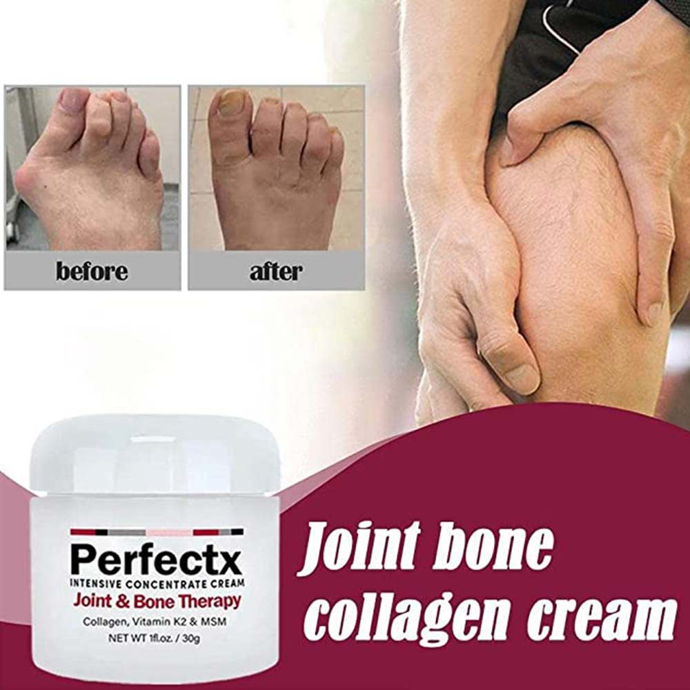 Perfectx Joint & Bone Therapy Cream, Natural Joint & Bone Therapy Cream ...