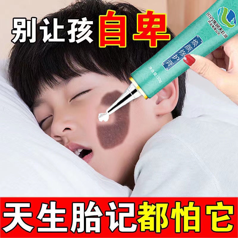 [TikTok same style] [quick removal of birthmark] Removal of birthmark ...