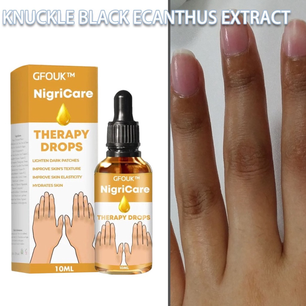 Therapy Drops Skin Acanthosis Nigricans Treatment Dark Spot Remover ...
