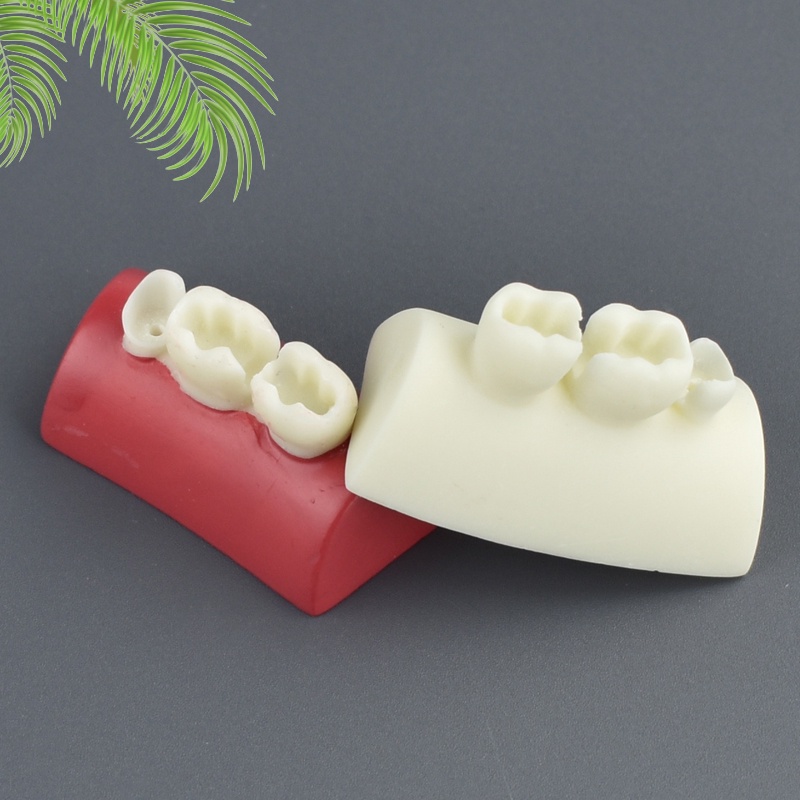 Filling Exercise Dental Model Block Inlay Exercise Resin Teeth Model ...