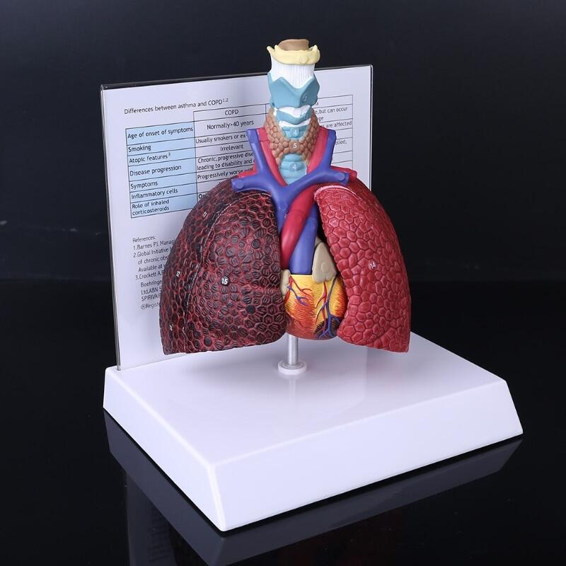 Life Size Human Lung Model Anatomical Respiratory System Anatomy For ...