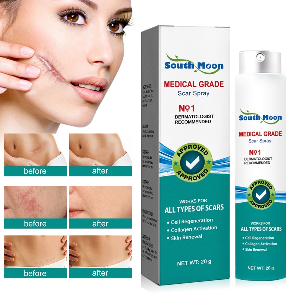 Scar Remover Spray 20g Repair Stretch Mark Firming Body Repair Burn ...