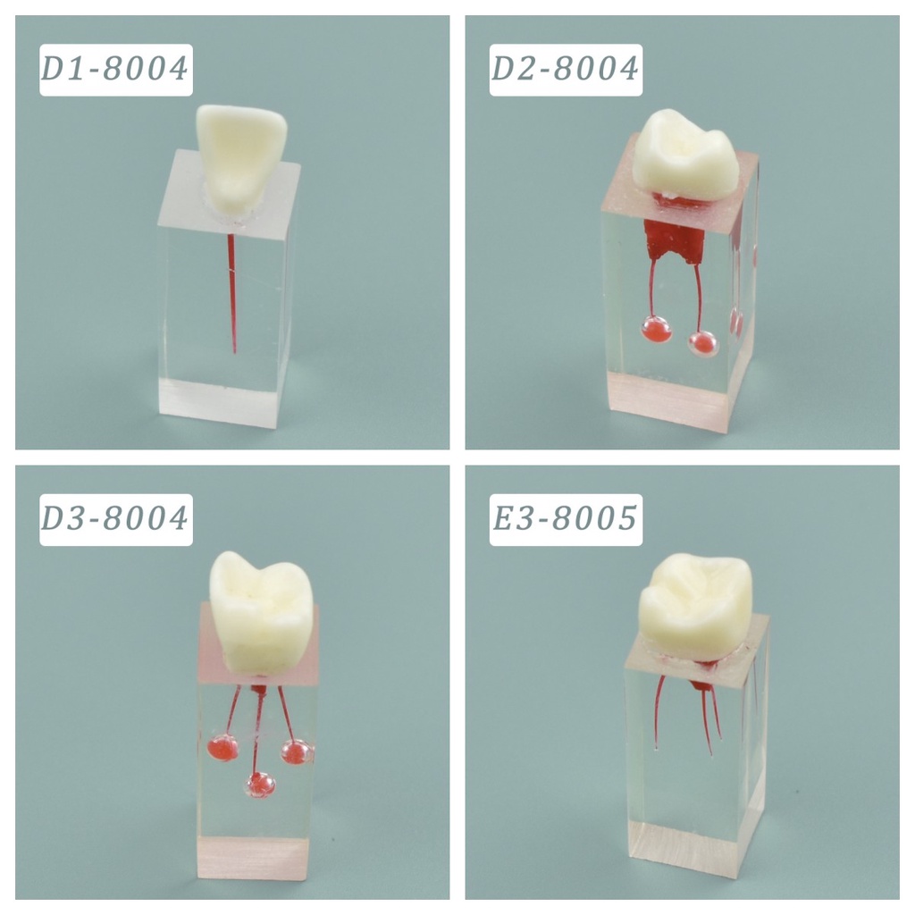 Dental Root Canal Model Dental RCT Practice Teeth Pulp Cavity Model ...