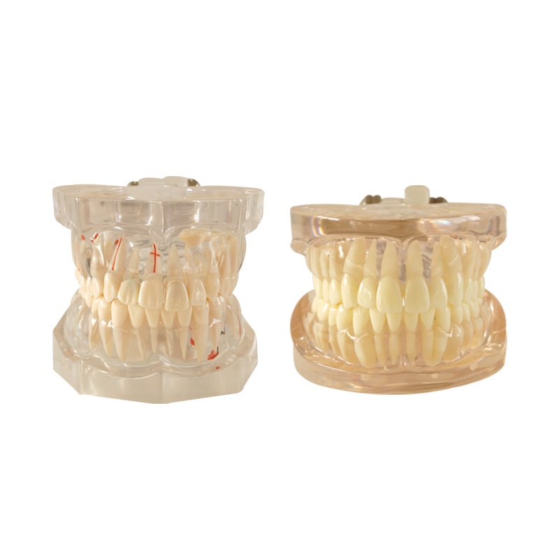 Dental Teeth Model 4 Times Periodontal with Nerve Model Teeth Model ...