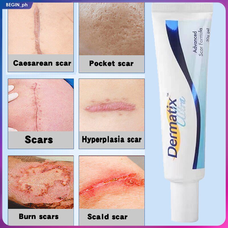 Dermatix 7days Scar Removal Cream Scar Repair Gel Fade Scars Burns