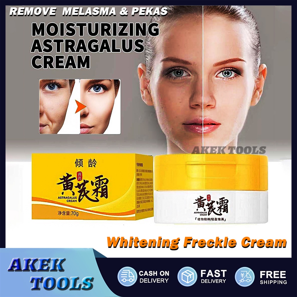 Astragalus Whitening Freckles Cream Remove Melasma Dark Spot Lightening ...