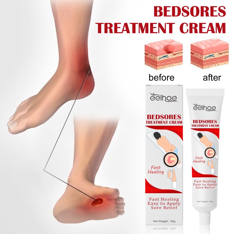 EELHOE Bedsores Wound Healing Cream Inhibit Fungal Sores Treatment Pain ...
