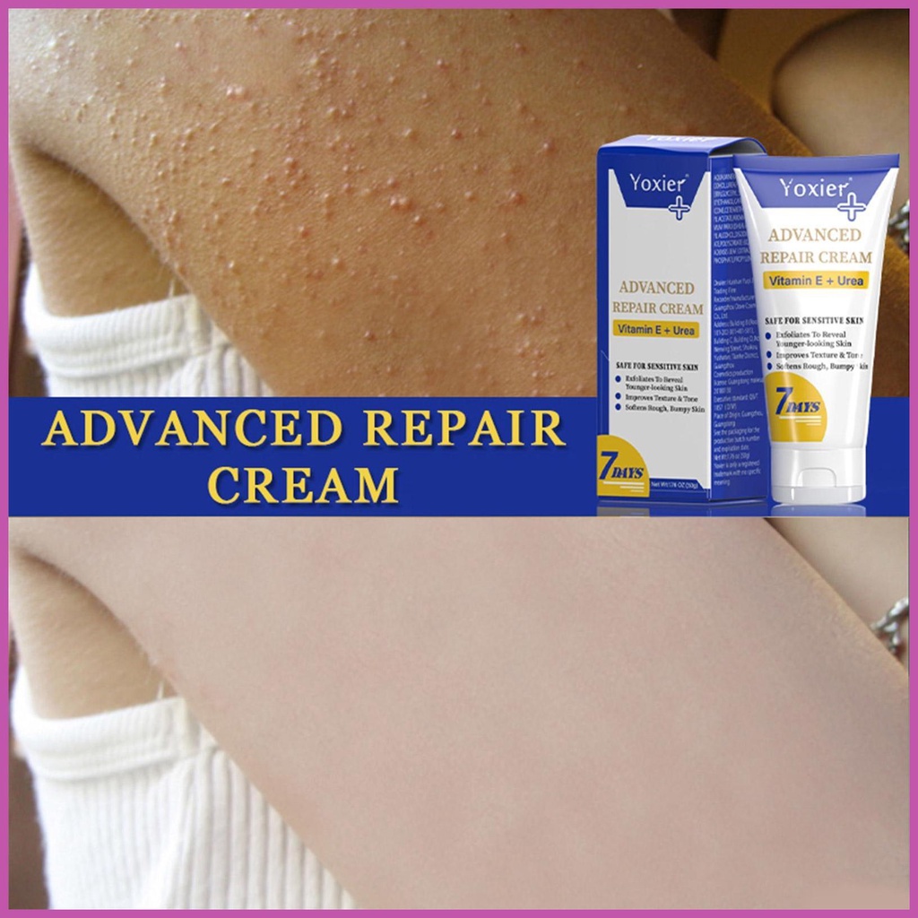 Advanced Repair Cream for Repairing Damage Moisturizing Body Cream for ...