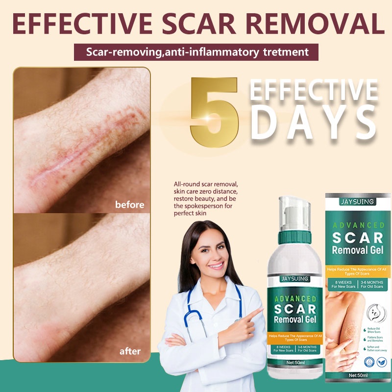 Advanced Scar gel remover scar remover cream scar remover for old scar ...