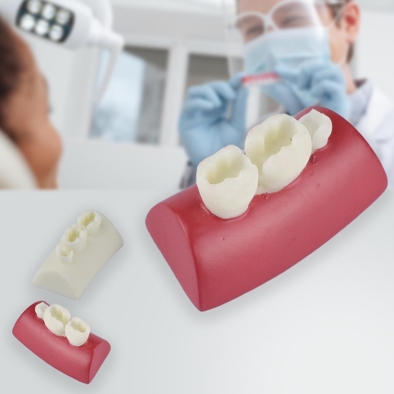 Dental Resin Block Filling Exercise Inlay Practice Model Teeth Model ...