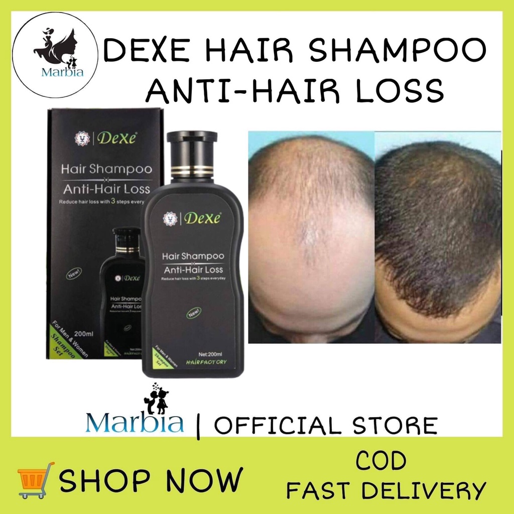 EFFECTIVE DEXE Anti Hair Loss Shampoo With Advance Formula 200ml, Hair ...