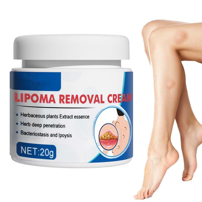 In StockM2 Lipoma Removal Cream Herbal Extract Care Fat Bulges Lump ...