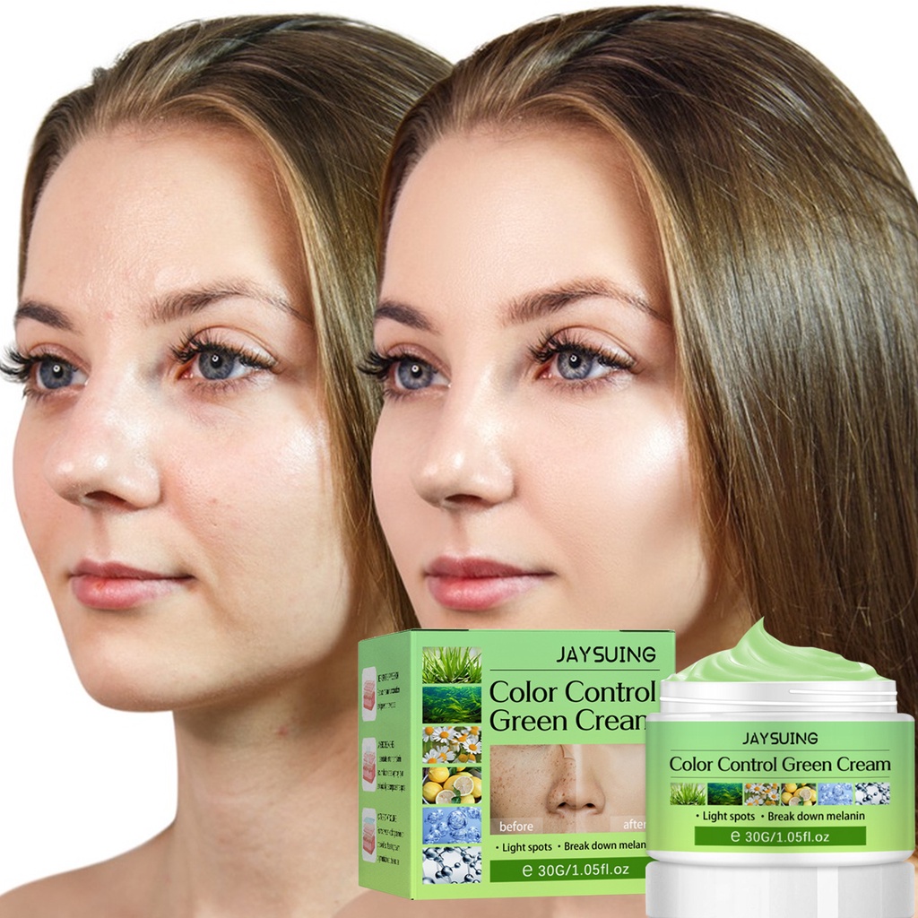 100% Original Whitening Freckles Cream Remove Melasma Dark Spot ...