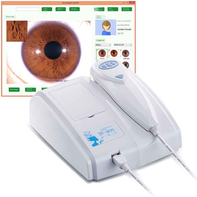 Digital Iridology Camera Iridology Analyzer Iris Analyzer Device Iris Diagnosis With Analysis ...
