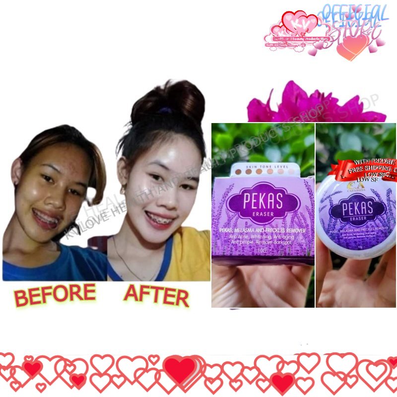 Capadosa Pekas Eraser Cream (10g) KV SHOPPING MALL | Shopee Philippines