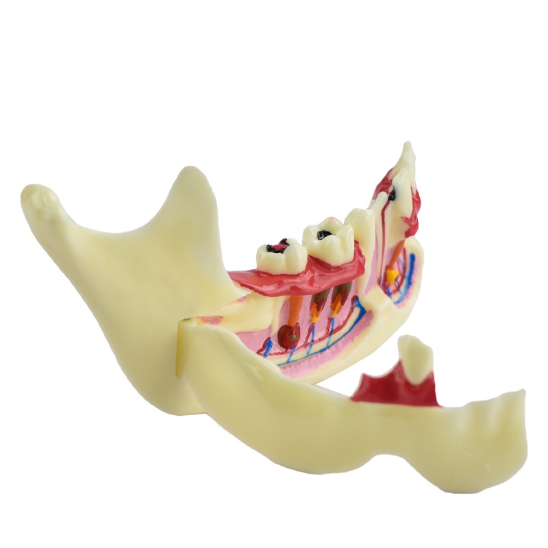 Treatment Model Mandible Tissue Anatomical Model Anatomy of Gums Dental ...